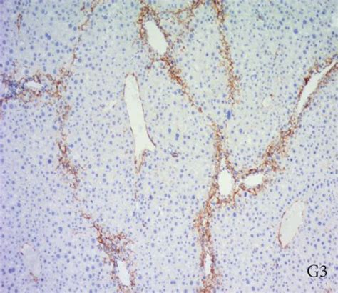 Immune Histochemical Analysis Of α Sma In Liver Sections Download