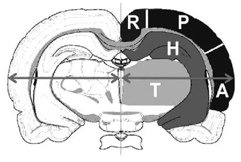 Regions Of Interest Selected For Analysis Were The Retrosplenial Cortex Download Scientific