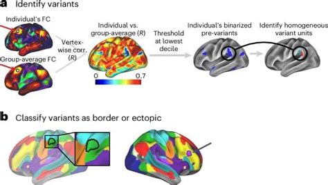 Two Common And Distinct Forms Of Variation In Human Functional Brain