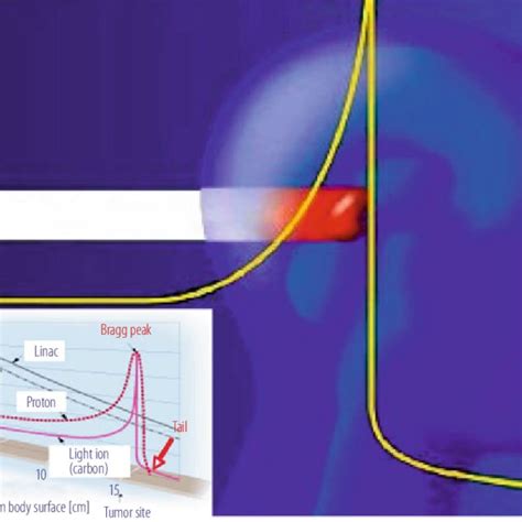 6 definition of the x ray transform and the sinogram download