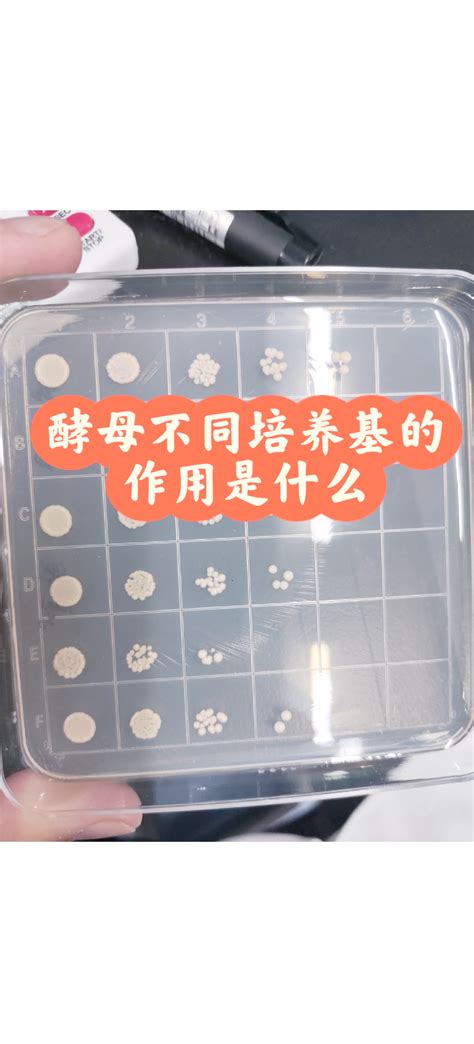 酵母实验中的缺陷培养基：你了解多少？