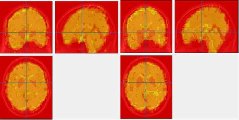 failed normalization of bold · issue 2410 · nipreps fmriprep · github