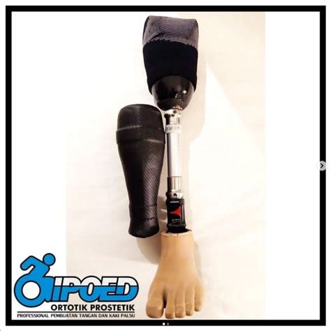 Soft Cover Transtibial Prosthesis Ipoed Op