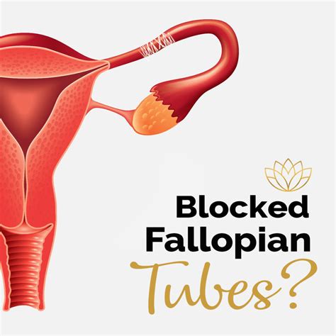 FTR Symptoms And Causes Of Blocked Fallopian Tubes Fibroid Treatment Clinic