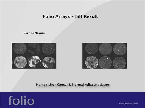 Tissue Microarray Presentation Key