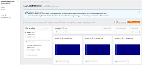 AWS Cloud Technology For Near Real Time Cardiac Anomaly Detection Using Data From Wearable