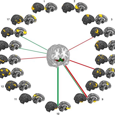 Functional Connectivity Fc Of Cholinergic Basal Forebrain Cbf Download Scientific Diagram