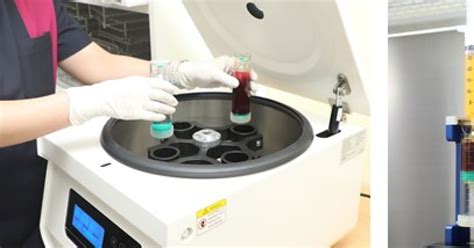 골수줄기세포 주사치료 추출은 정확하게 활성도는 높여야