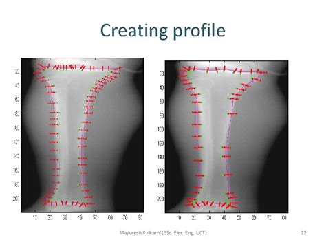 Xray Image Segmentation Using Active Shape Models Mayuresh