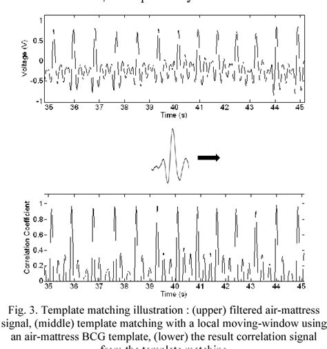 Figure 3 From Automatic Ballistocardiogram Bcg Beat Detection Using A Template Matching