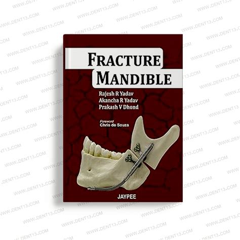 Fracture Mandible انتشارات بازیار Dent13