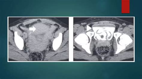 Ct Mri Urography Pptx