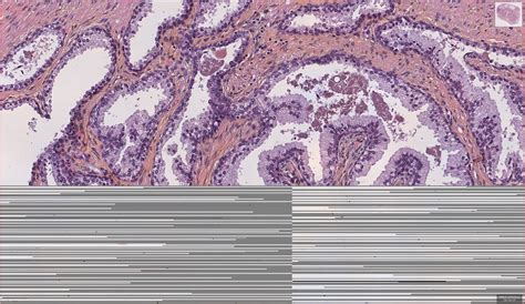 Problem With Ndpi Files Usage And Issues Imagesc Forum