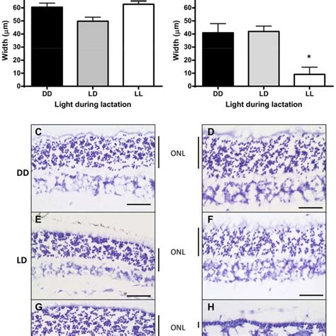 Postnatal Light Effects On Retinal Morphology In C57bl6j And Cd1 Adult Download Scientific