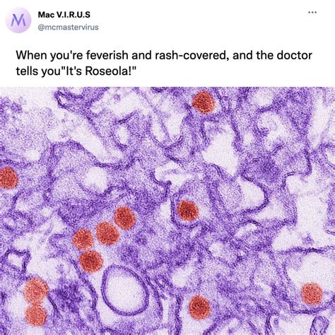 Roseola