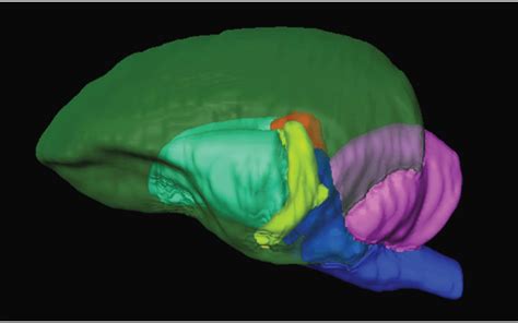 Three Dimensional 3d Brain Reconstruction The 3d ­reconstruction
