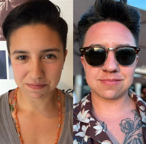 My Microdosing Testosterone Journey By Cas Castrejon They Them Jun 2023 Medium