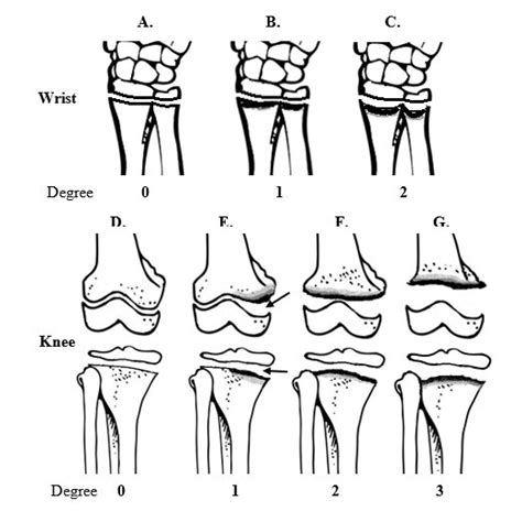 Reference Ranges Of Tmpgfr According To Age And Sex Download