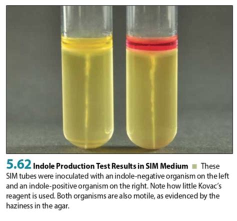 Sim Test Microbiology