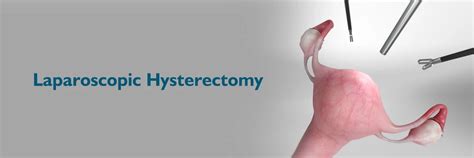 Laparoscopic Hysterectomy Saamaynta Dhinacyada Khatarta Soo Kabashada