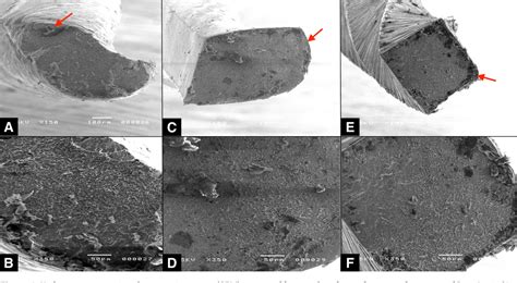 Figure 1 From Cyclic And Torsional Fatigue Resistance Of Thermally