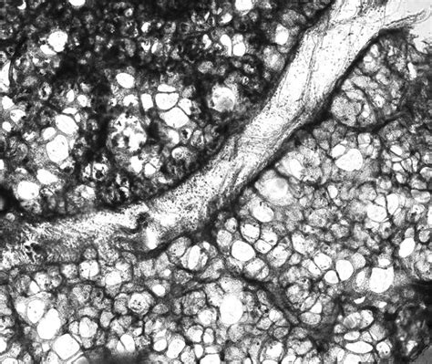 Human Precision Cut Lung Slice Pcls 001e 17 Male Hispanic Cell Systems