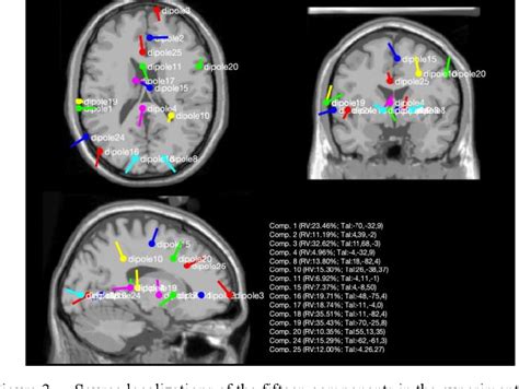 Figure 1 From Eeg Signal Analysis For Early Detection Of Critical Road
