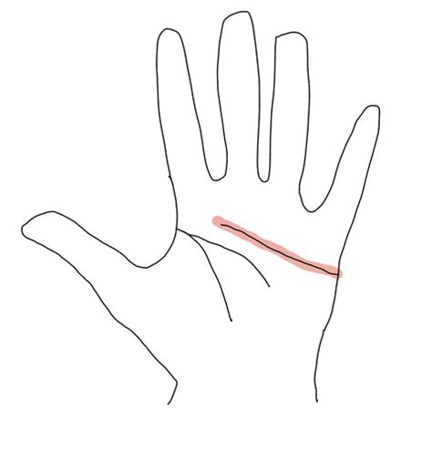 Fingerprint Pattern Types Flashcards Quizlet