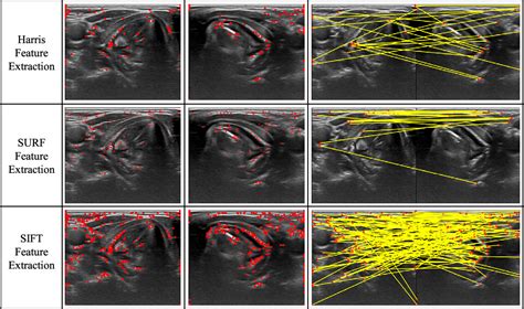 Figure 5 From Larynx Ultrasound Image Stitching Based On