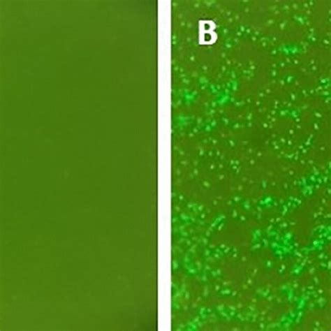 Result Of Immunofluorescent Assay Ifa Using Fluorescence Microscope