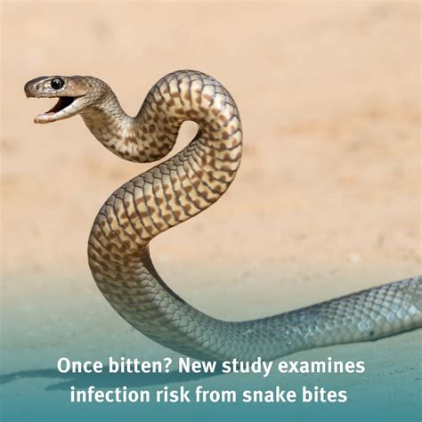 Once Bitten You May Have Heard That A Bite From A Crocodile Can Result