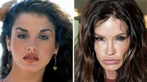 Top 10 Worst Celebrity Plastic Surgery Fails Of All Time