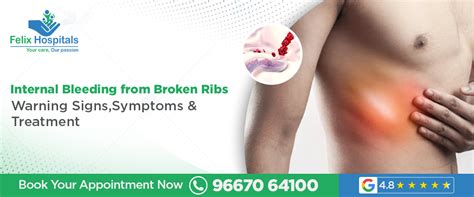 Internal Bleeding From Broken Ribs Warning Signs Symptoms And Treatment