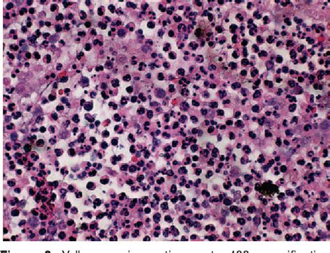 Figure 1 From Early Inflammatory Reaction After Rotator Cuff Repair With A Porcine Small