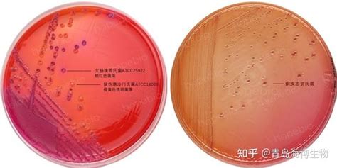 常用大肠杆菌分离和计数培养基的比较分析 知乎