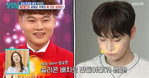 “실리콘 탓 코 막혀” 박서진 여동생 성형수술 디스에 분노 살림남 [결정적장면]