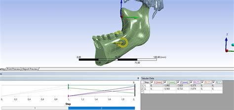 Reply To Remote Displacement Static Structural