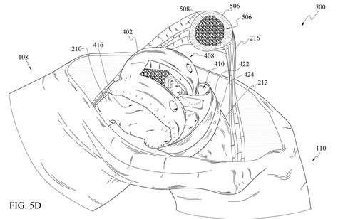 Patent Drawings And Their Importance In A Patent Specification Invntree