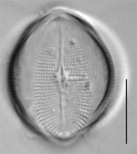 Compare Cocconeis Placentula Species Diatoms Of North America