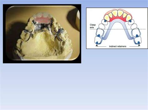 Kennedy Class Iv Pptx