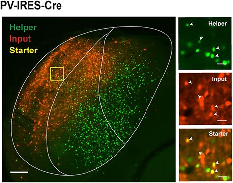 This Week In The Journal Journal Of Neuroscience