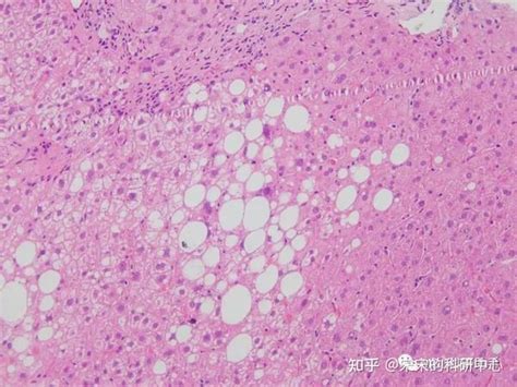 切片学习 常规病理组织切片及诊断要点 知乎