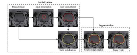 The Workflow Of The Cdls Method For Bladder Wall Segmentation Colour Download Scientific