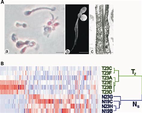 Characterization Of Dfs Spermatozoa And Transcript Clustering A
