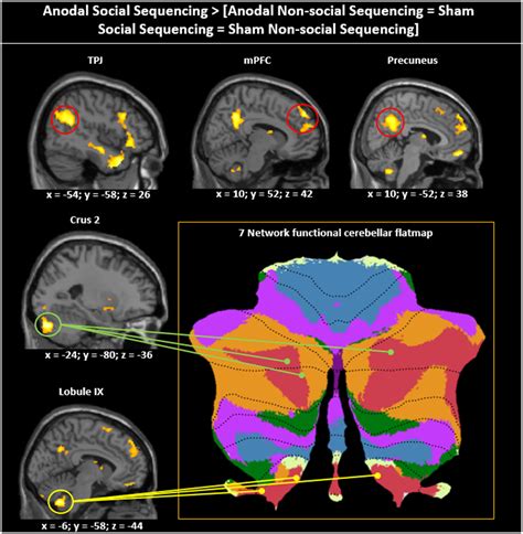 Exciting The Social Butterfly Anodal Cerebellar Transcranial Direct