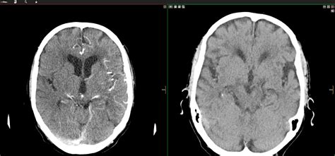 Best Dicom Viewers For Windows Macos Web And Mobile 2024 Radiogyan