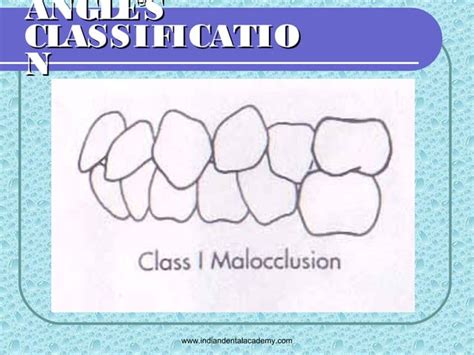 Angles Classification And Its Shortcoming 2 Ppt