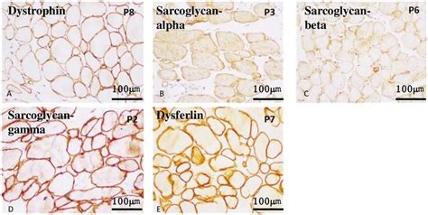 Immunohistochemistry Using Antibodies Against Dystrophin Download