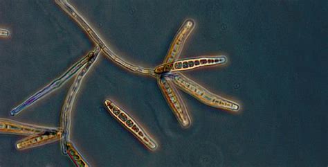 Updated Adult Sinusitis Guidelines Released Consultant360