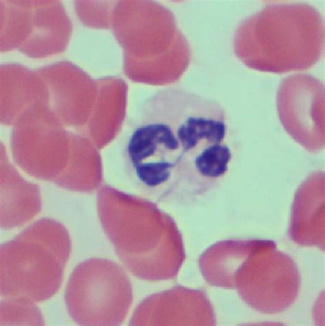 Figure 1 From Detection Classification And Counting Rbcs And Wbcs